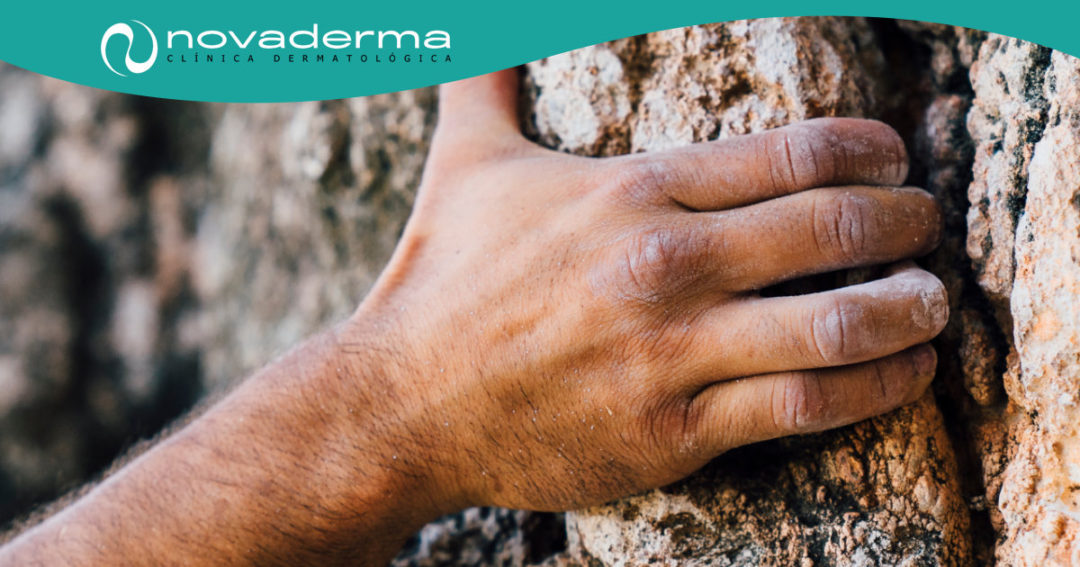 ¿Por qué se agrietan y estropean nuestras manos? - Clínica ...